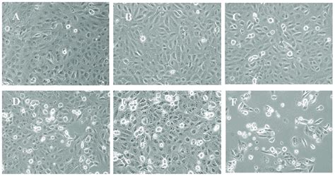 Comparison Of The Morphology Of Du145 Cells Treated With Dtx Oct Alone