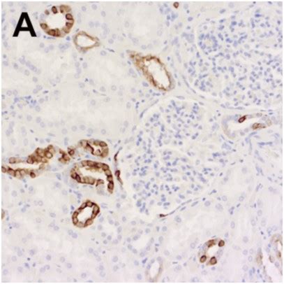 ヒト腫瘍の異種移植片におけるサイトケラチン7の検出に有用な抗体 抗cytokeratin 7（ck7）抗体（histosure抗体シリーズ