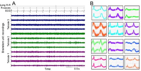 Identification Of Simultaneous Activity Of Multiple Neurons In Three Download Scientific