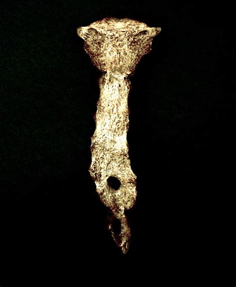 Chief Teaches Anatomy Sternum Xiphoid Process The Sharp Projection At