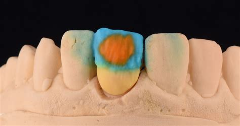 Clinical Case By Andreas Chatzimpatzakis