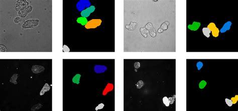 Figure 1 From Domain Adapted Multitask Learning For Segmenting Amoeboid