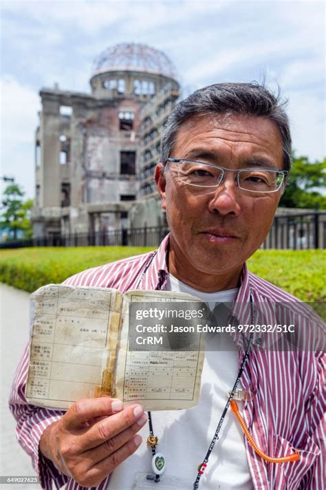 An Inutero Survivor Of The Hiroshima Atomic Bomb Attack Displays His