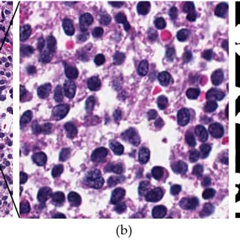 Sample Histopathology Image For Nuclear Segmentation A Download Scientific Diagram