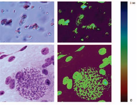 Figure 1 From Segmentation Driven Retinanet For Protozoa Detection