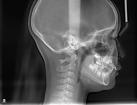 Нүүр амны рентген зургийн төрлүүд