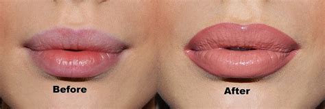 Make Lips Look Bigger Without Makeup Saubhaya Makeup
