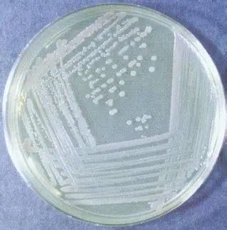 Nutrient Agar Composition Preparation And Uses Learn Microbiology