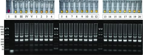 Lamp Amplifies Wt Or Mt Idh1 In Patient Derived Tumor Samples Without A Download Scientific