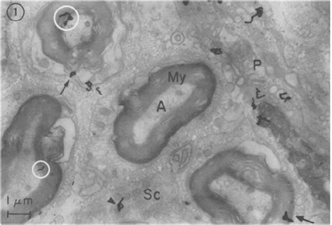 An Electron Microscope Autoradiograph Of A Cross Section From The