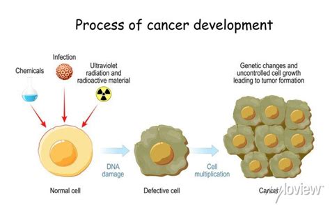 Process Of Cancer Cell Development Posters For The Wall • Posters Skin