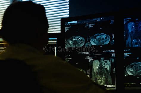 医生看核磁共振扫描 包图企业站