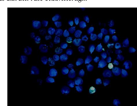 Figure 5 From Detection Of Aflatoxin Contamination In Corn Using The Simplified Gabor Wavelet