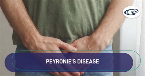 Peyronies Disease Symptoms Peyronies Disease Htjry