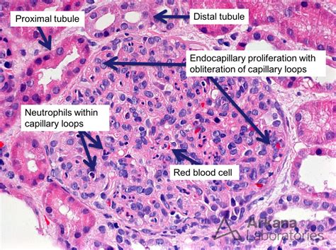 Case 1 Diagnosis And Conclusions Nephsim