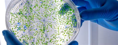 Sondage Vésical Hygiène Prévention Et Contrôle De Linfection