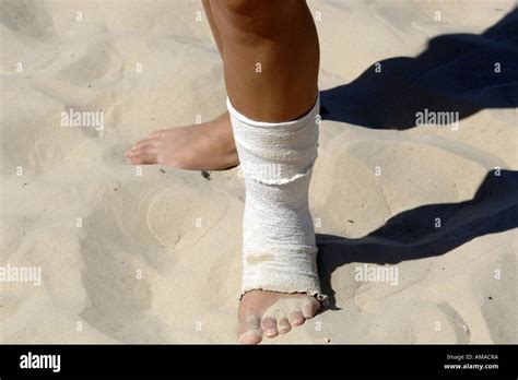 Female Sprained Ankle