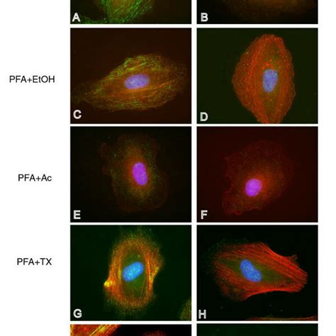 Results Of Fixing And Permeabilizing Conditions On Phospho Mlc And Download Scientific Diagram