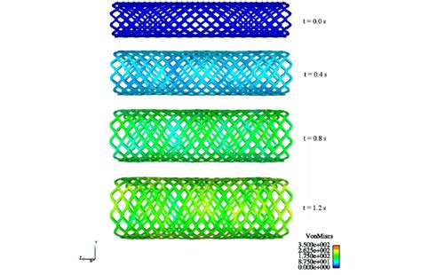 Von Mises Stress Along The Stent At Different Time Steps Download Scientific Diagram