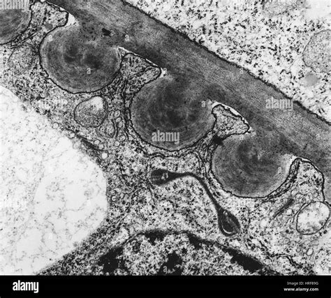 Chloroplast Electron Micrograph