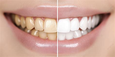 A Split Screen Close Up Of An Attractive Woman S Mouth One Side Showing Her Teeth With Yellowish