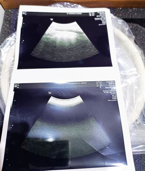 Used Very Good Ge C1 5 Rs For Sale 2 388 Usd Item 1974703 Bimedis