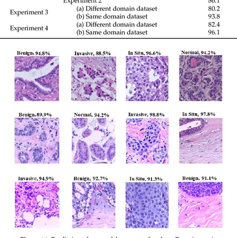 Figure 1 From Optimizing The Performance Of Breast Cancer Classification By Employing The Same