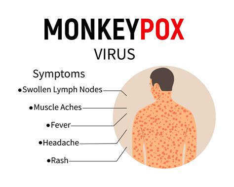 Monkeypox Testing Fast Track Urgent Care