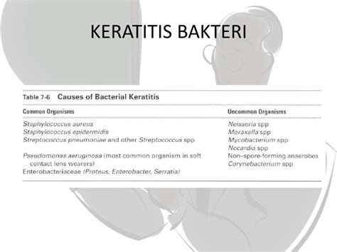 Ppt Keratitis Powerpoint Presentation Free Download Id7377600