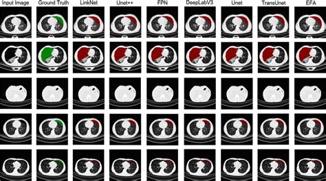 This Image Presents The Segmentation Results Of Randomly Selected