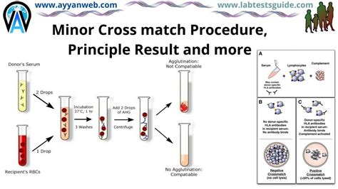 What Is Crossmatch At Nate Hocking Blog