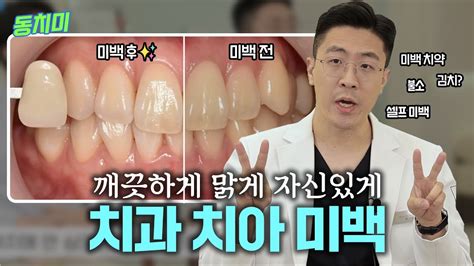 얼마나 받아야 하얘질까 치과에서 받는 치아 미백과 셀프 미백의 차이점은｜치아 미백의 모든 것 Youtube