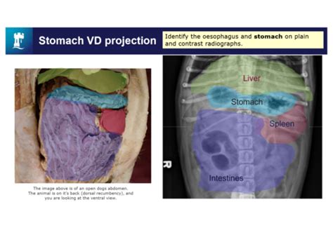 Stomach Flashcards Quizlet