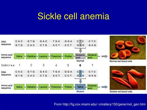 Ppt Hemoglobinopathies Thalassemia And Sickle Cell With Brief Mention Of A Few Others