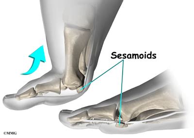 Sesamoid Bone