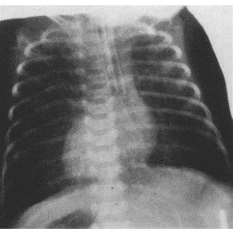 Radiograph With Collimator In Position Download Scientific Diagram