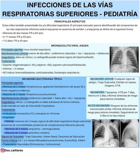 Infecciones De Las VÍas Respiratorias Superiores En PediatrÍa Dr