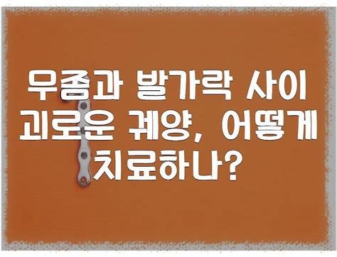 무좀과 발가락 사이 괴로운 궤양 어떻게 치료하나