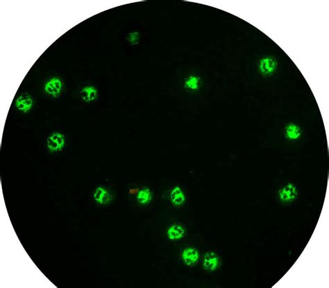 Pattern Controls Immuno Concepts
