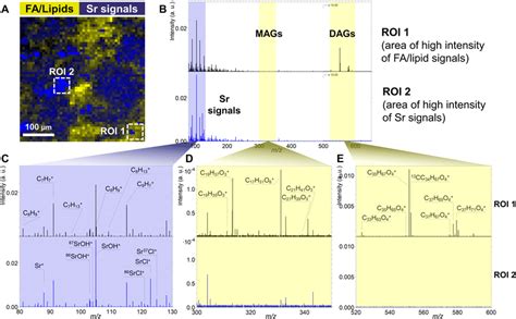 Analysis Of Sr 2 Diffusion Into Rat Bone Marrow Of Osteoporotic Rat