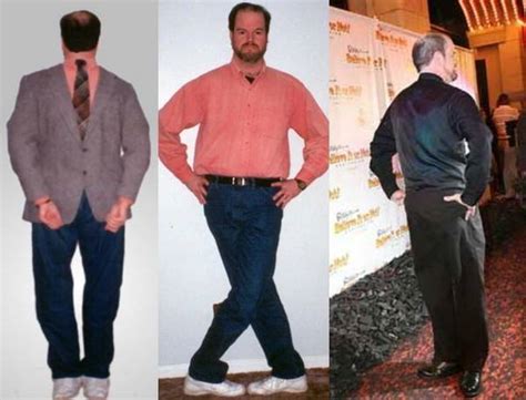 Moses Lanham Un Vrai Super Heros Capable De Tourner Ses Jambes à Lenvers Et Marcher De Dos