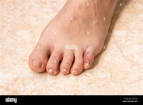 Pinky Toe Bump