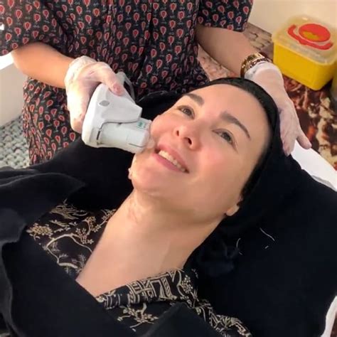 Ulthera 1 The Aivee Clinic