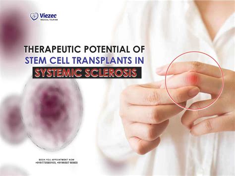 Potential Of Stem Cell Transplants In Systemic Sclerosis