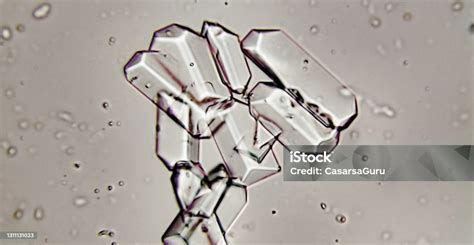Microscopic View Of Calcium Oxalate And Hippuric Acid Crystals From