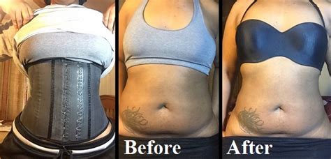 Waist Training Before And After New Health Advisor