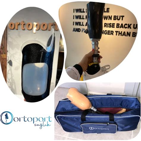 Prosthetic Socket Ortoport