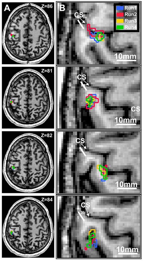 Spatial Reproducibility Of Bold Signals Download Scientific Diagram