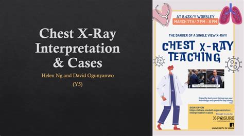 Cxr Interpretation And Cases Content Medall
