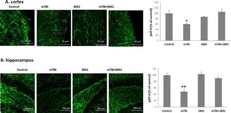 The Neuroprotective Effect Of Gm1 Administration On Axonal Regeneration Download Scientific